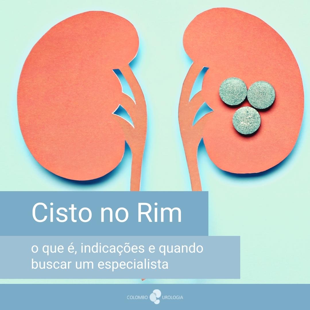 Cistos de Rim - O que é, Causas, Sintomas e Tratamentos 【Atualizado】